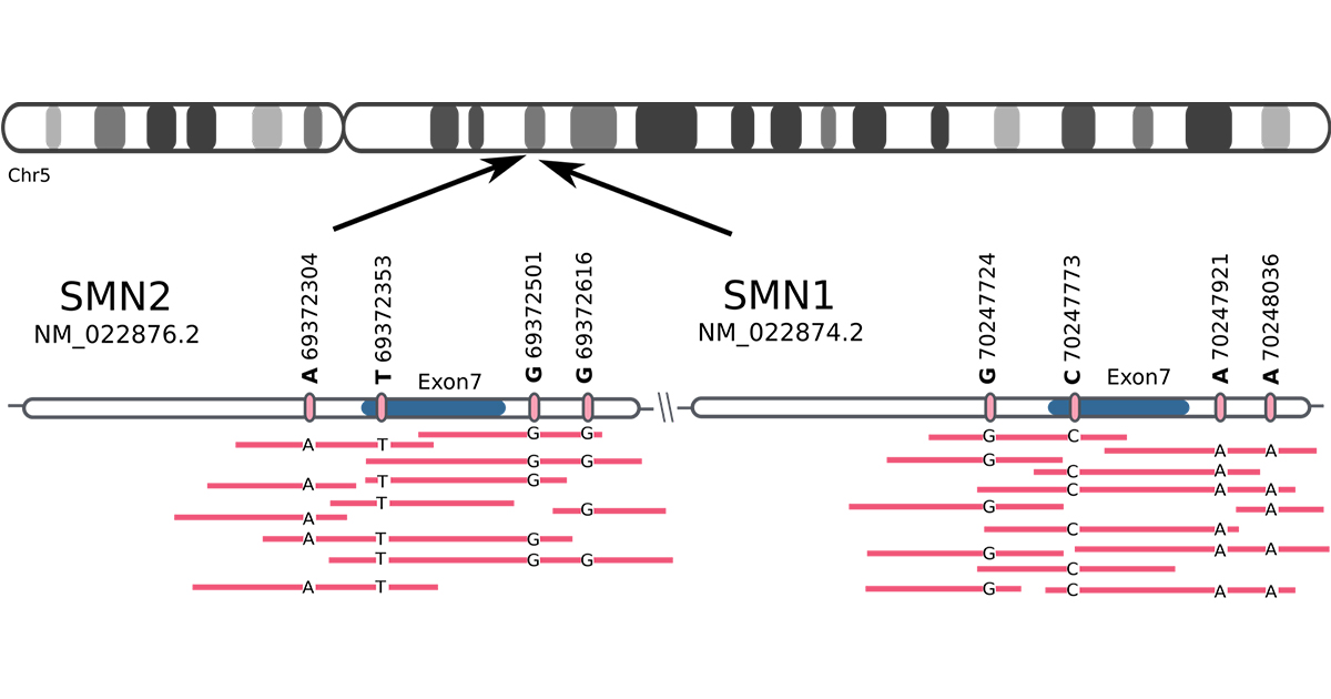 Accurately resolving copy number variation in highly homologous SMN1 ...